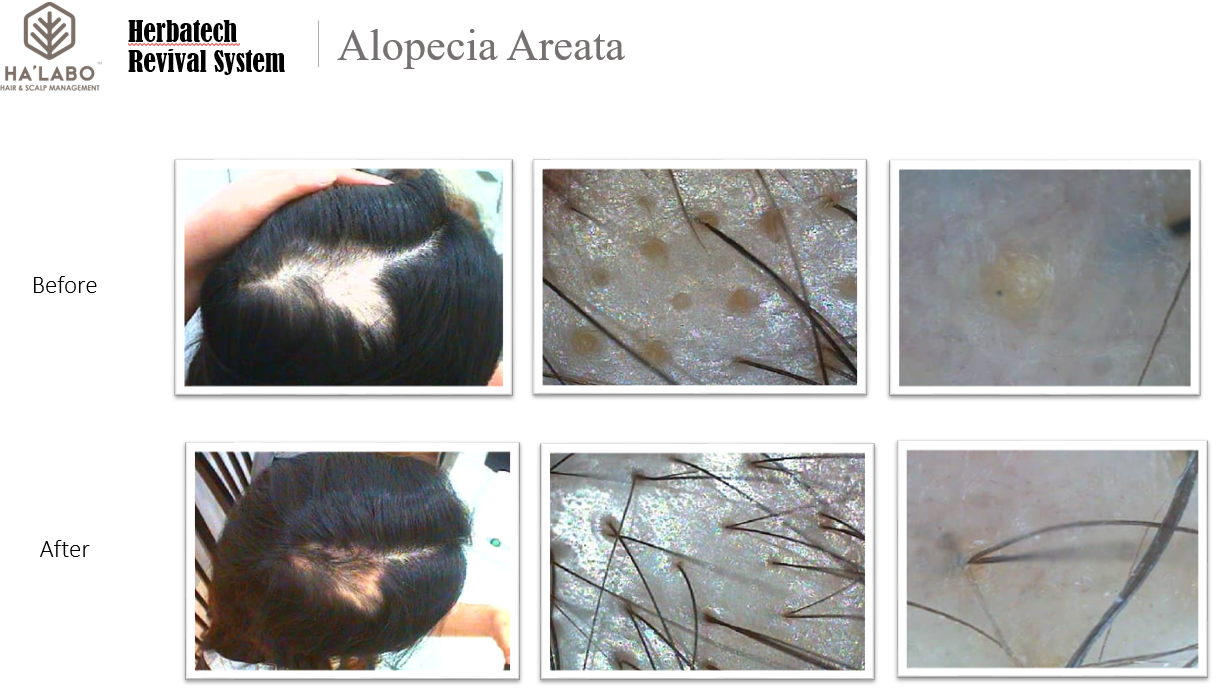 Your 1st Journey with Ha’Labo – Halabo e-store